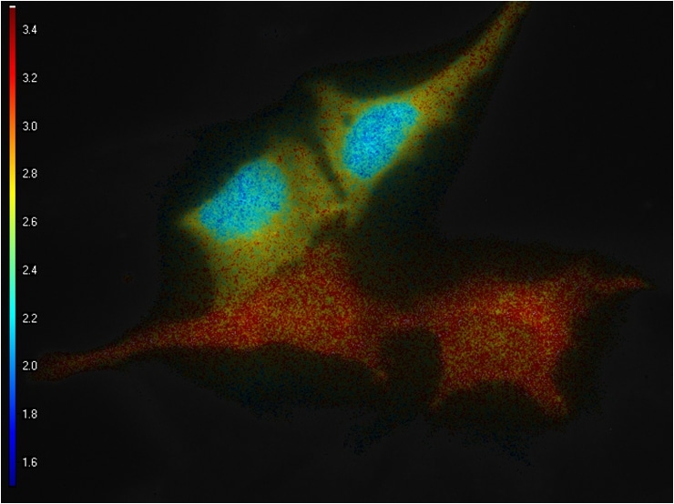 Fluorescence Lifetime Imaging Microscopy (FLIM) System