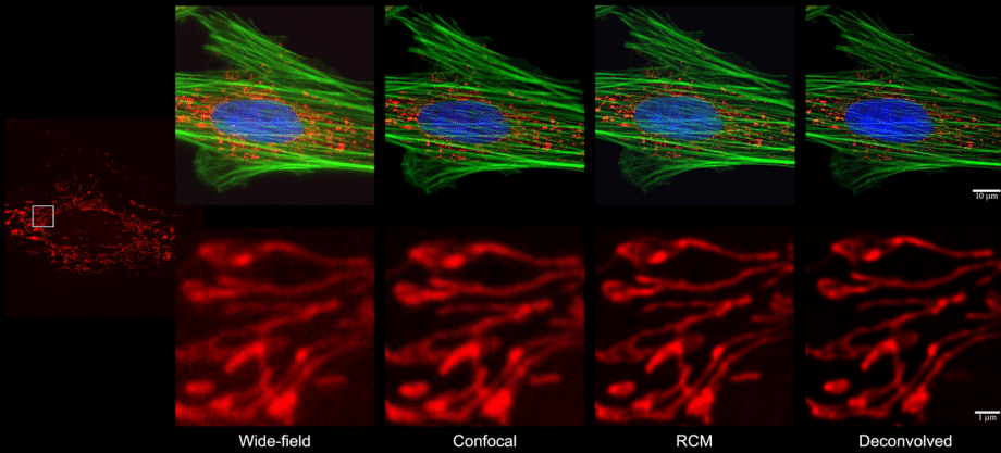 Rescan Confocal Microscopy Add-On | RCM2 | Axiom Optics