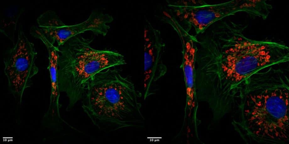Rescan Confocal Microscopy Add-On | RCM2 | Axiom Optics