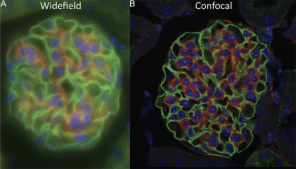 Confocal Microscopy Applications | Axiom Optics.