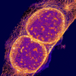 High-Speed sCMOS Camera | Kinetix