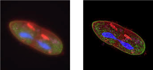 Main Differences Between Confocal and Widefield Microscopy