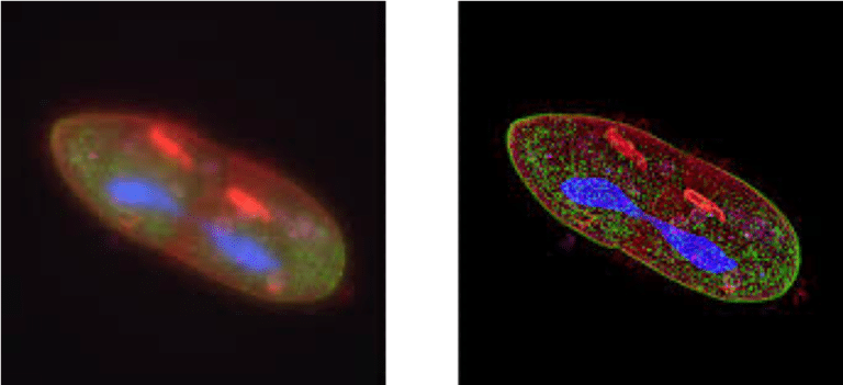 Main Differences Between Confocal and Widefield Microscopy