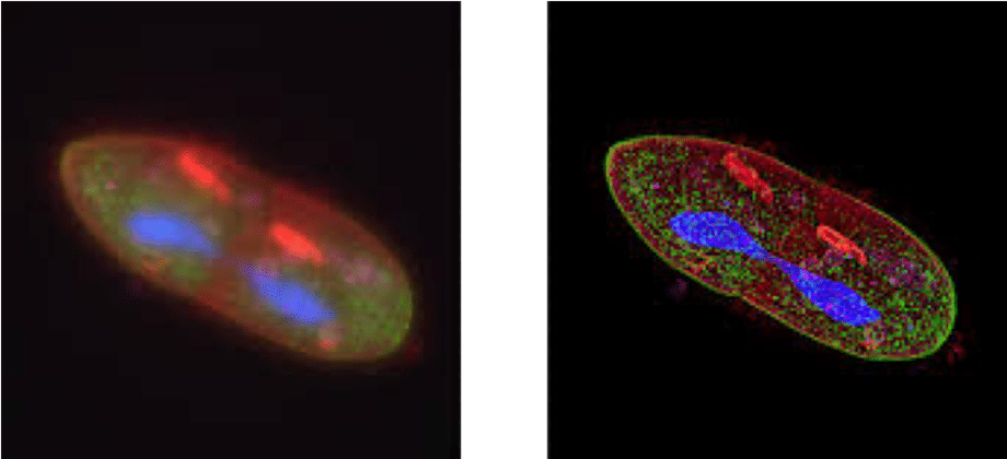 Main Differences Between Confocal and Widefield Microscopy